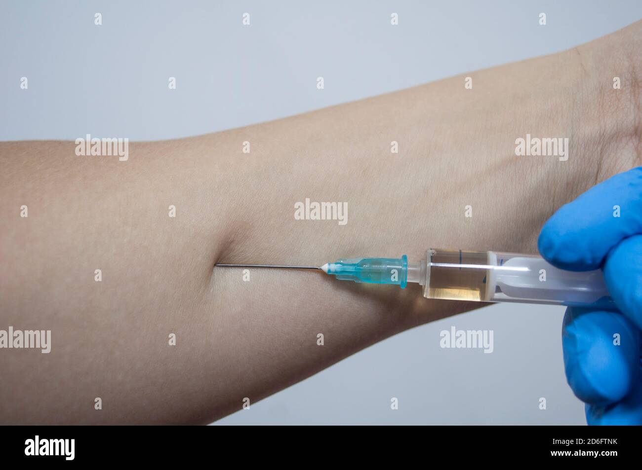 Hand in gloves makes an injection in the arm, injection, vaccination ...