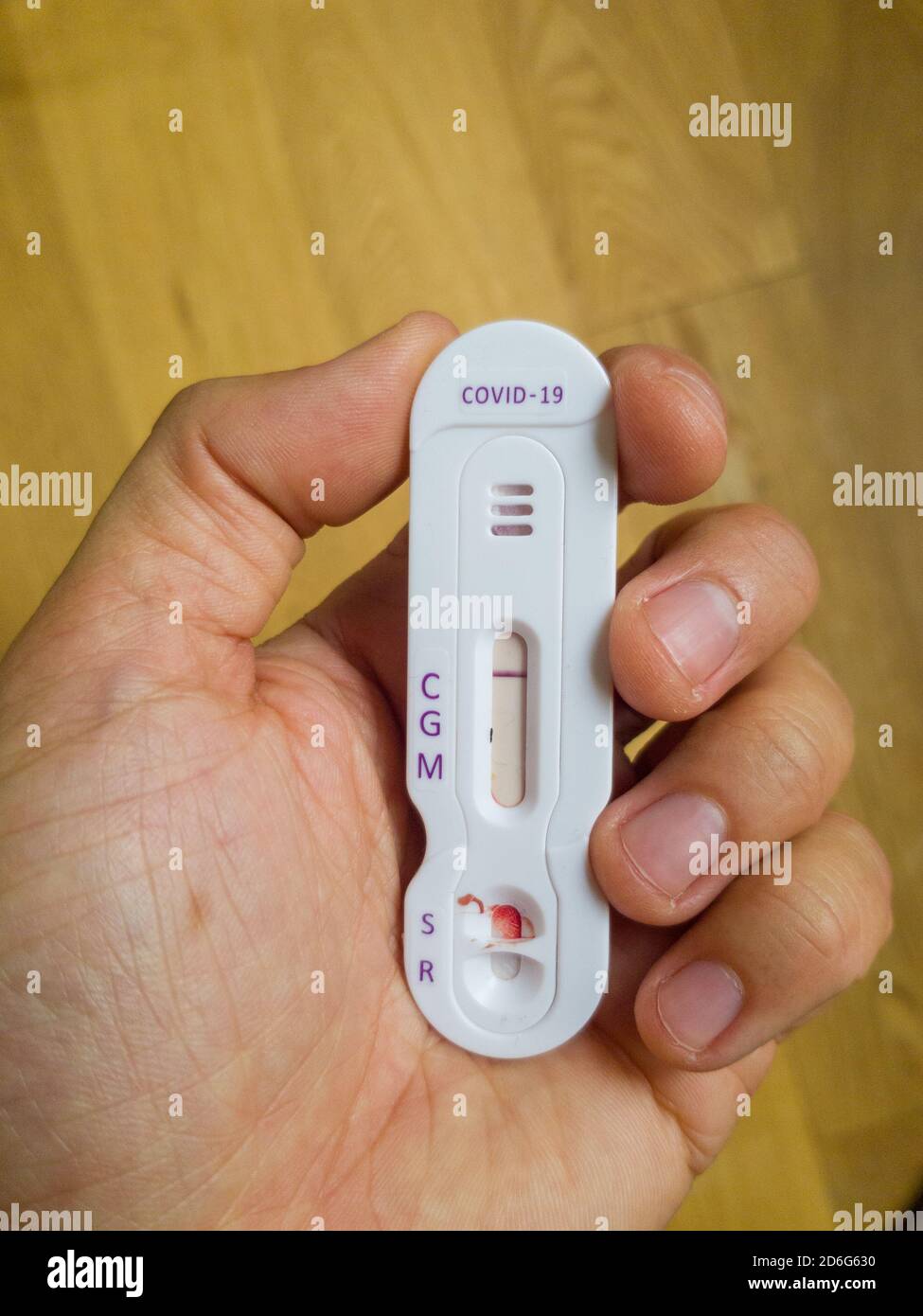 Igg High Resolution Stock Photography and Images - Alamy