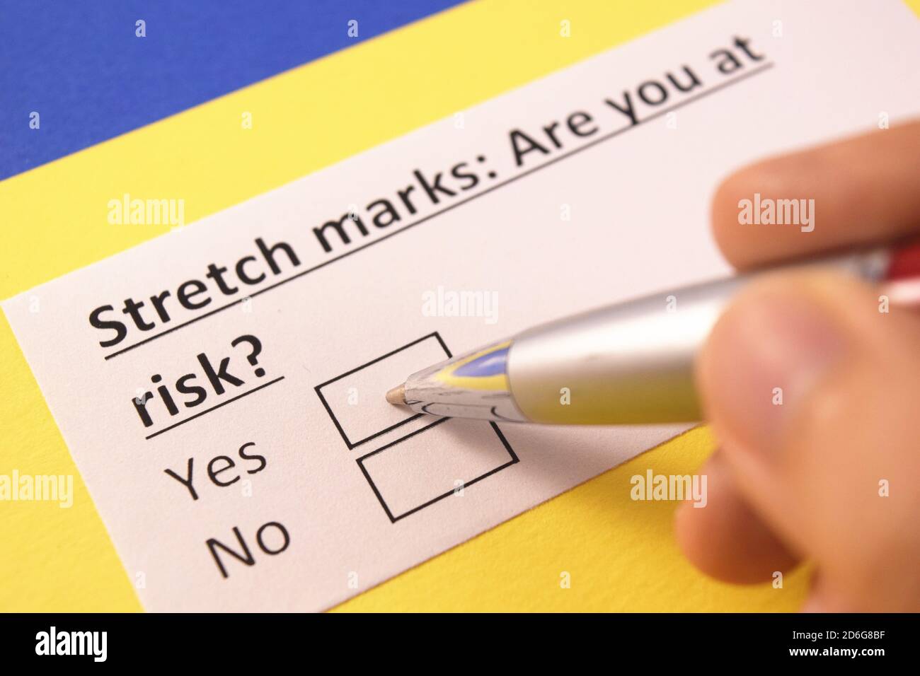 Stretch marks: Are you at risk? Yes or no Stock Photo - Alamy