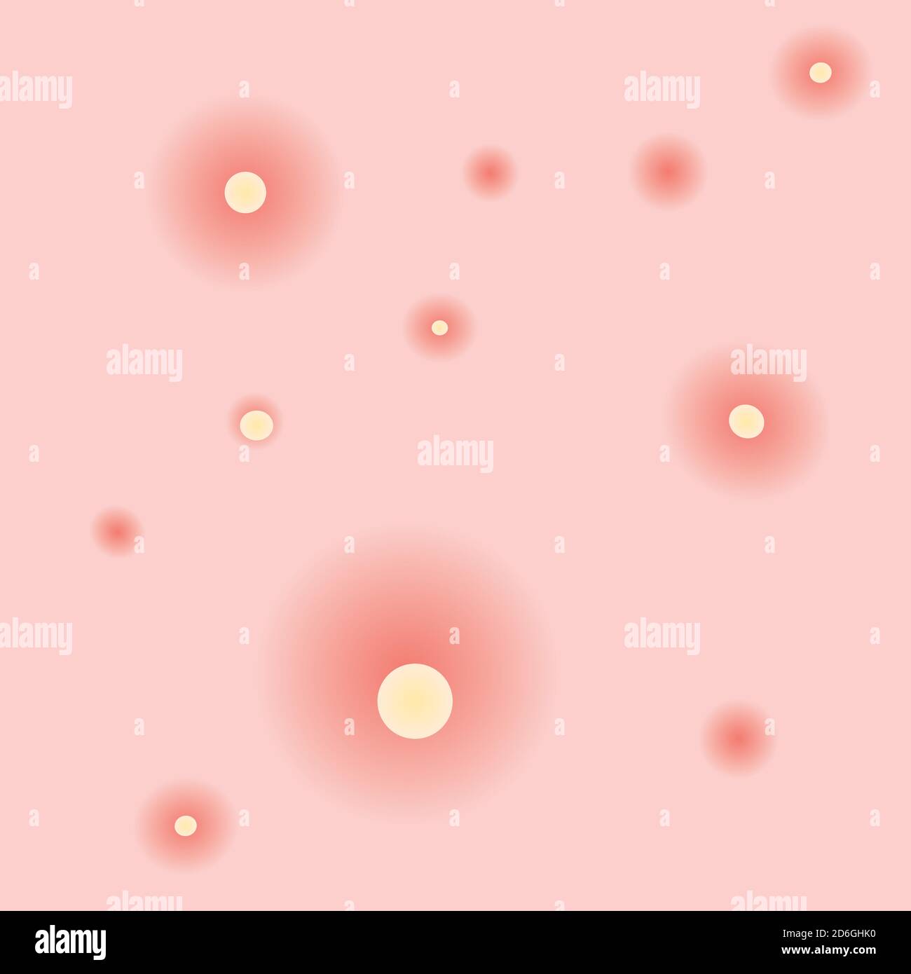 skin with acne, pimple texture- vector illustration Stock Vector Image ...