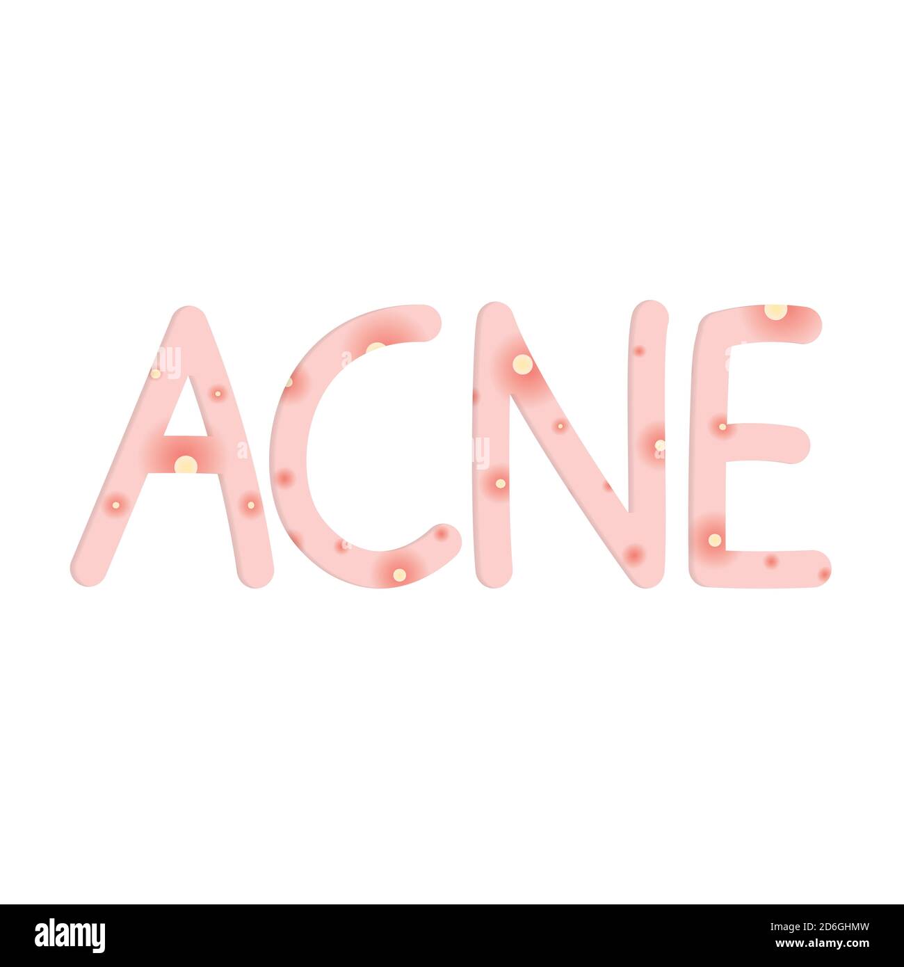 acne word concept- vector illustration Stock Vector Image & Art - Alamy