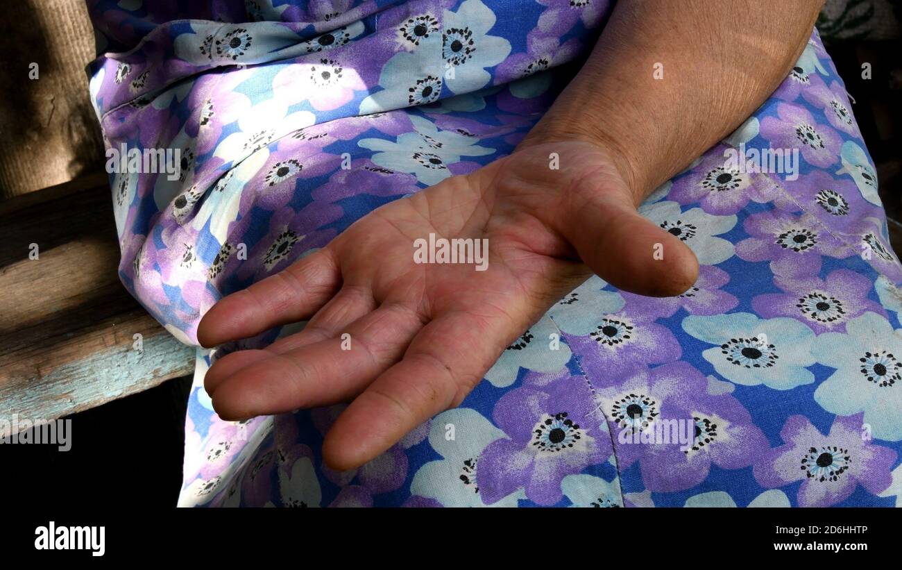 Opened palm hand of senior woman of 80 year old. Damaged wrinkled elder ...