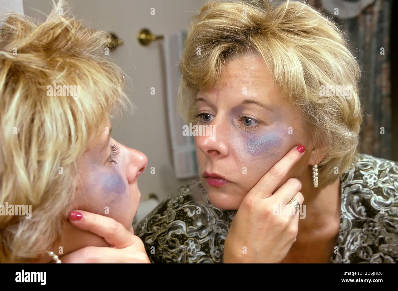 Battered face hi-res stock photography and images - Alamy