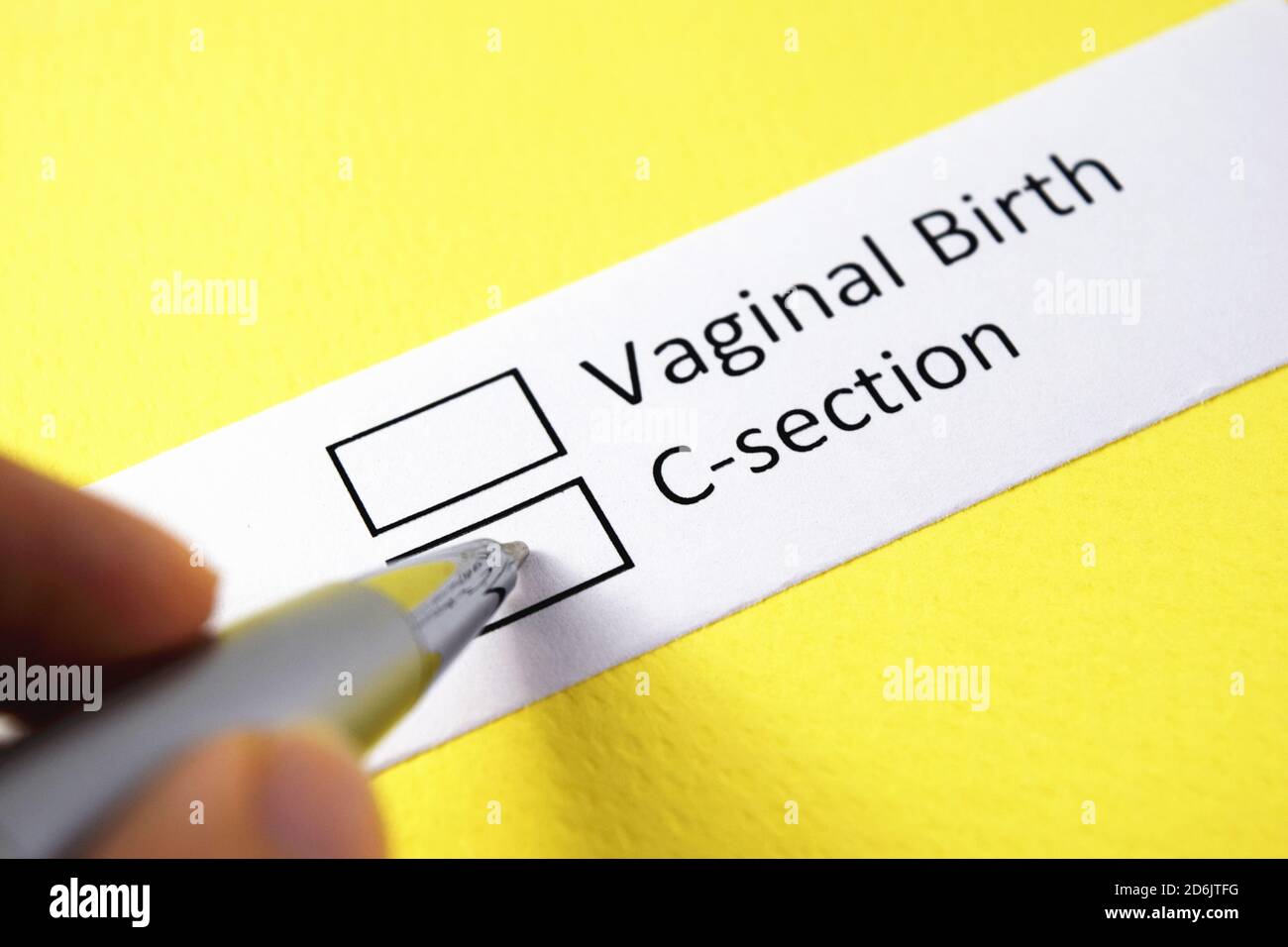 Vaginal Birth or C-section? C-section Stock Photo - Alamy