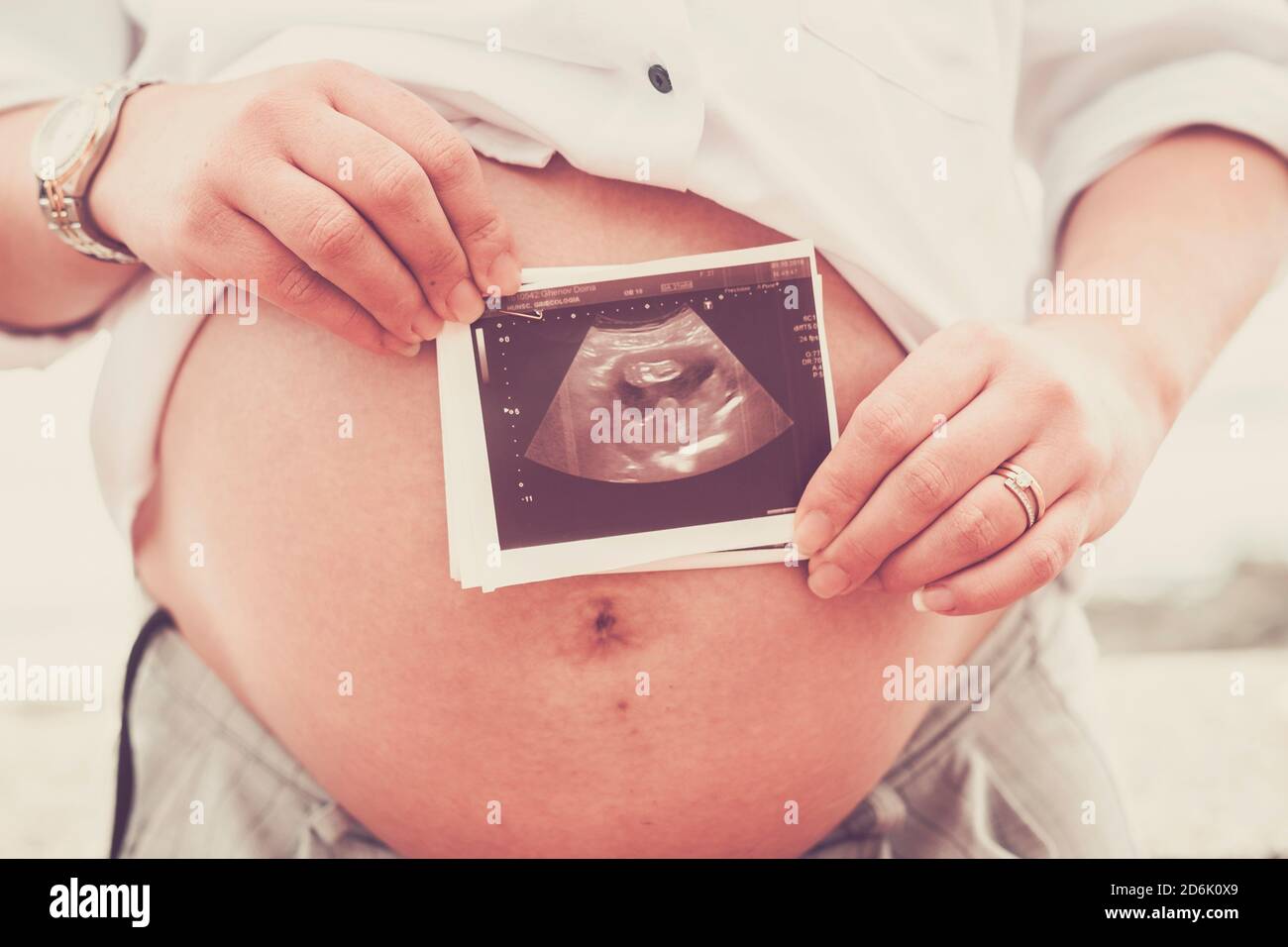 Young caucasian woman show his x-ray baby picture for newborn and ...