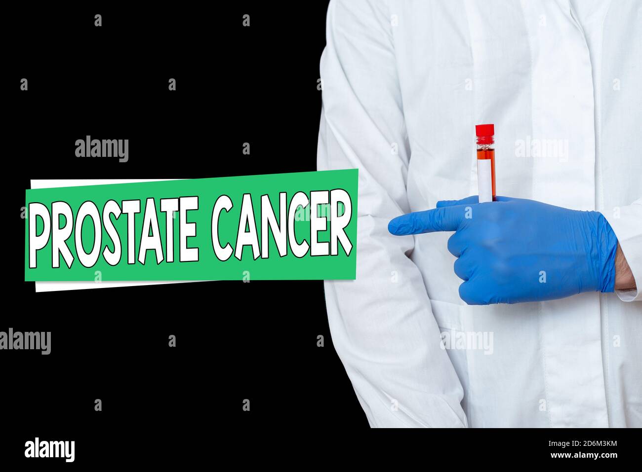 Writing note showing Prostate Cancer. Business concept for development ...