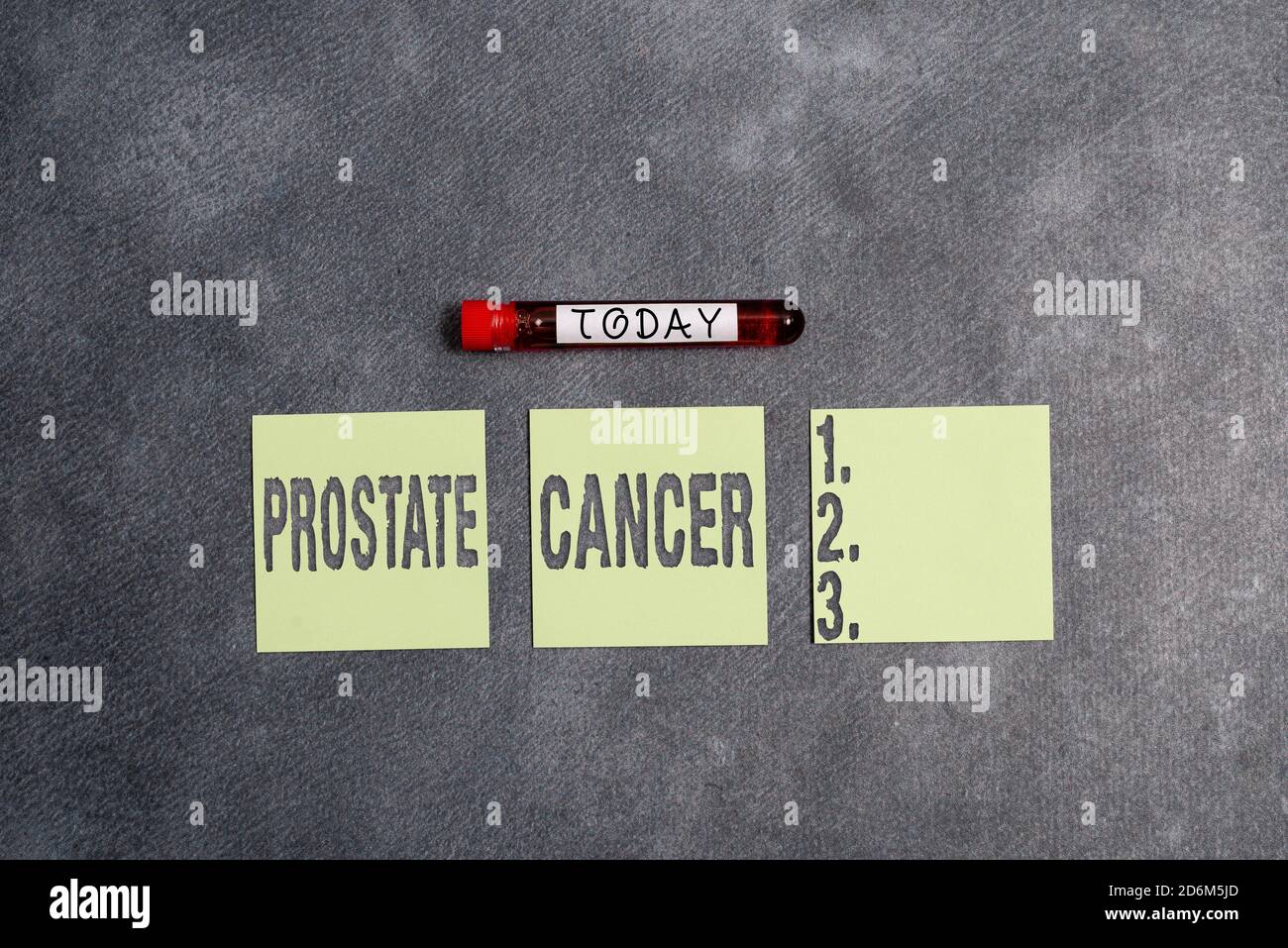 Conceptual hand writing showing Prostate Cancer. Concept meaning ...