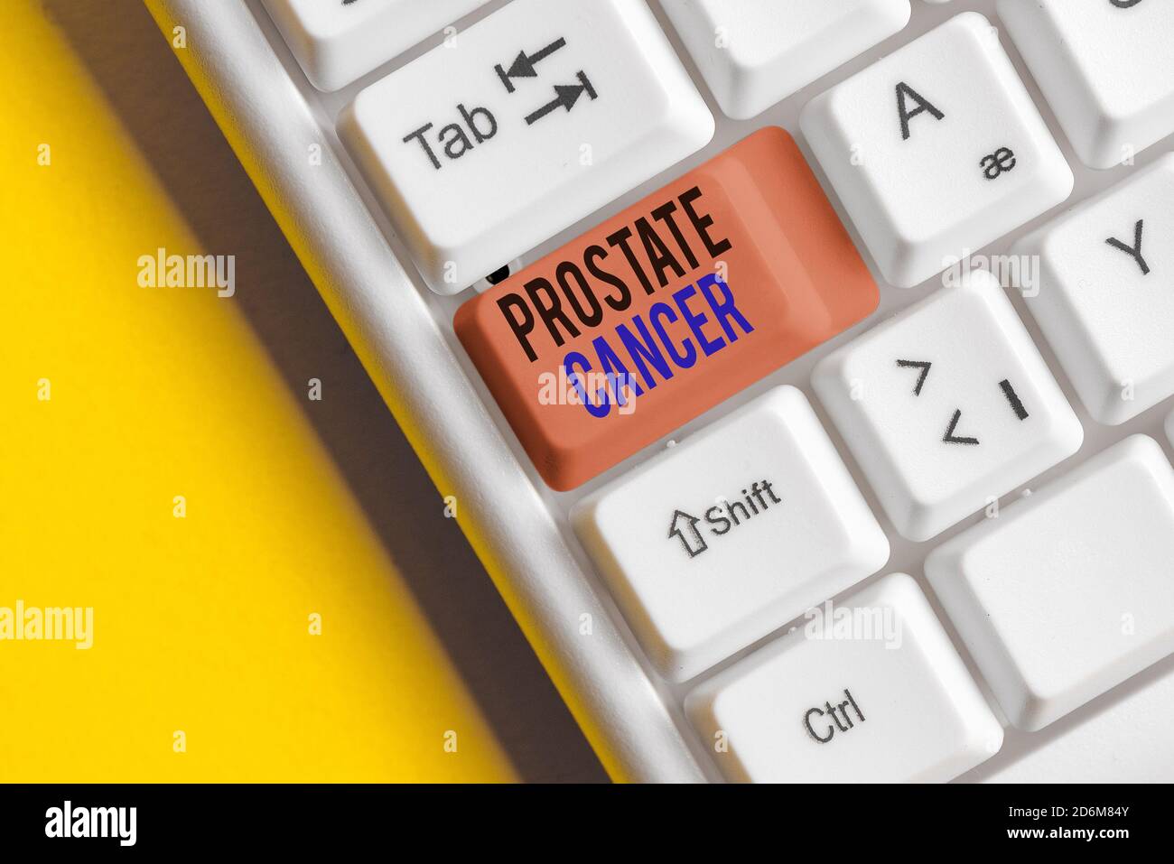 Text sign showing Prostate Cancer. Business photo showcasing ...