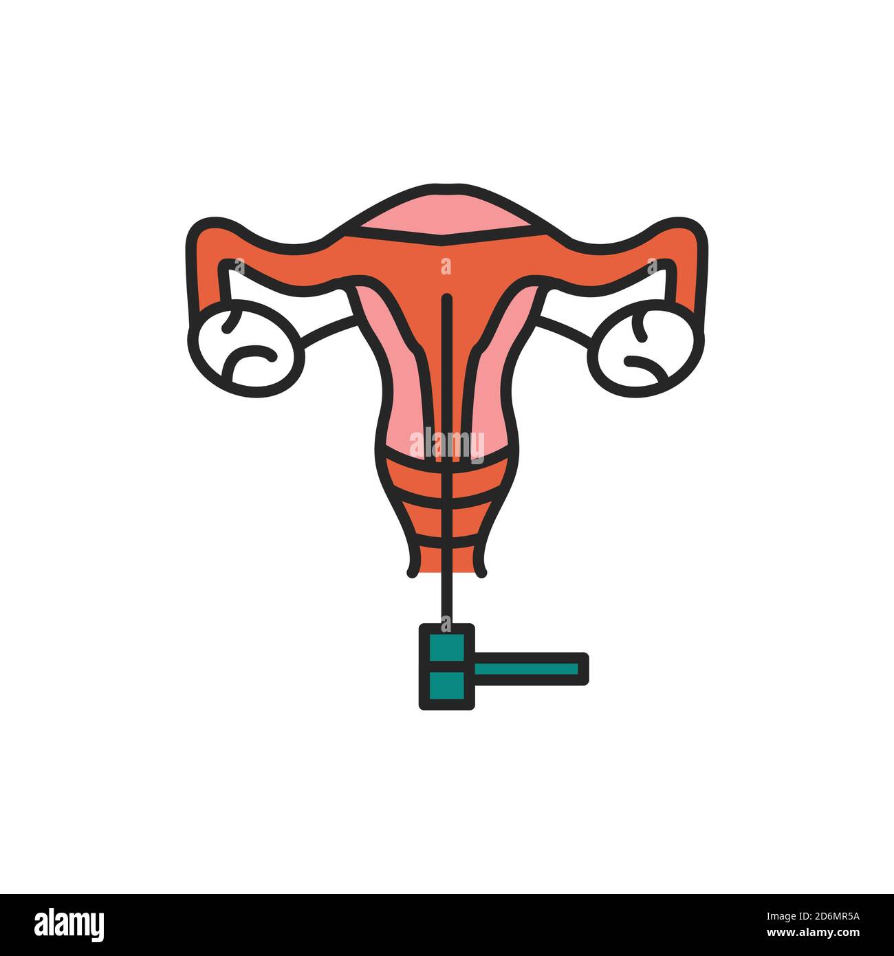 Hysteroscopy line color icon. Female reproductive system checkup. Sign ...
