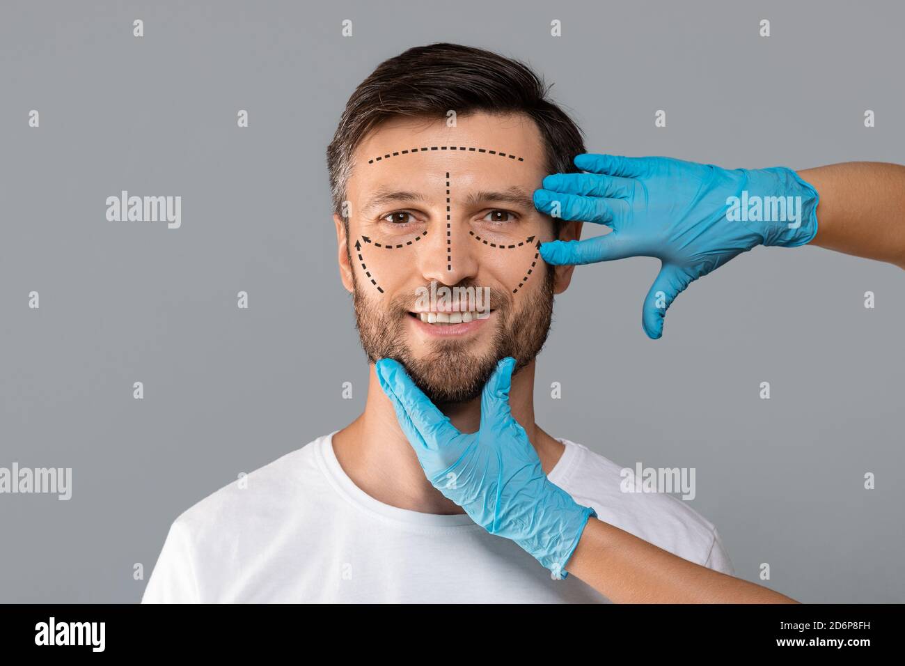 Cheerful man with pencil marks on skin Stock Photo - Alamy