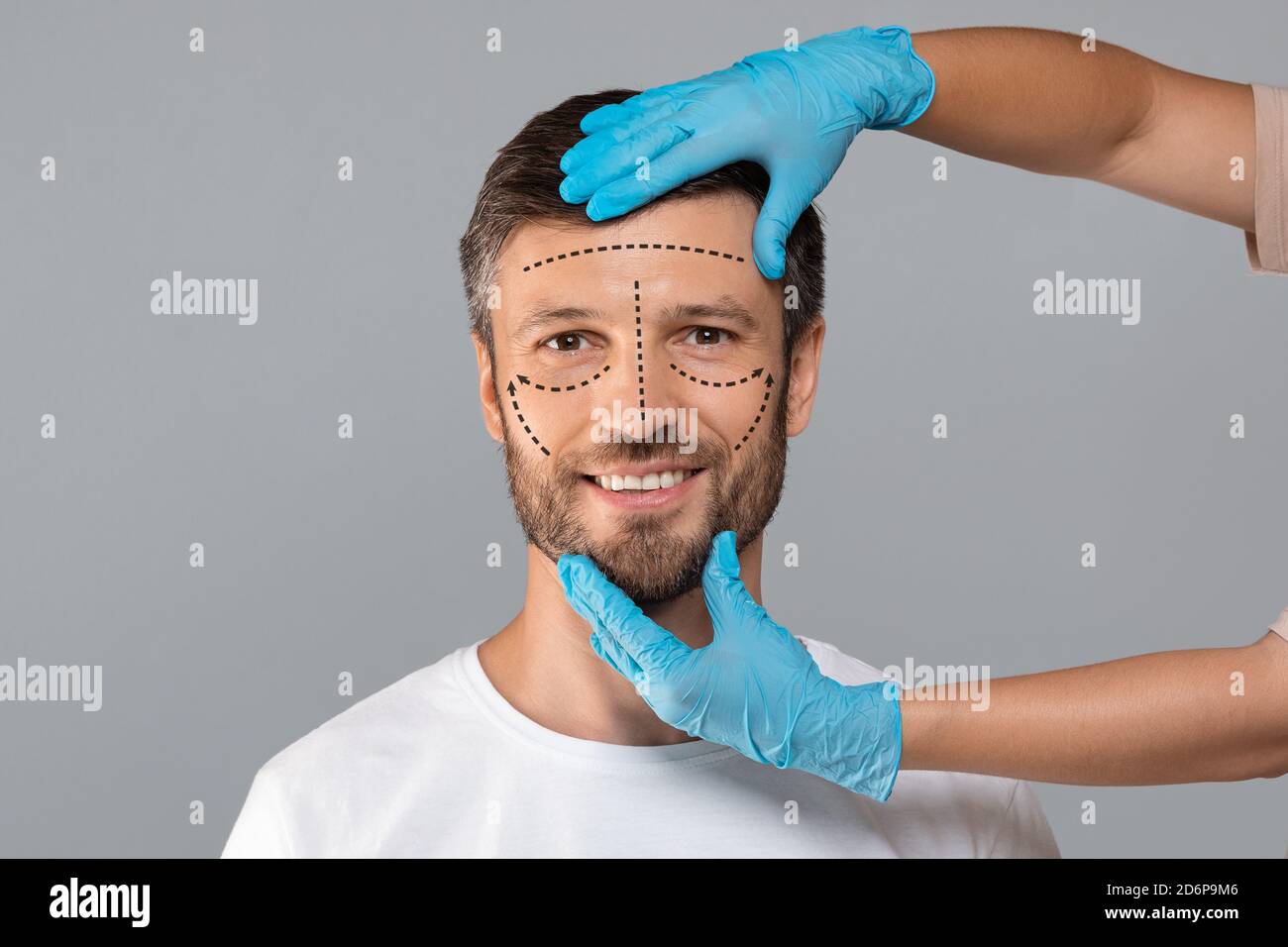 Handsome middle-aged man with pencil marks on skin Stock Photo - Alamy