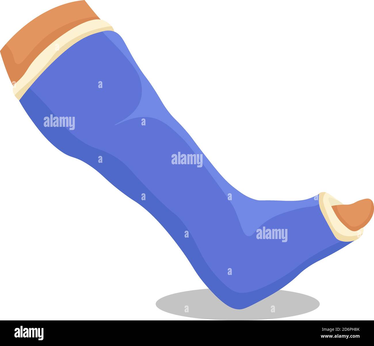 Plastered leg ,illustration, vector on white background Stock Vector ...