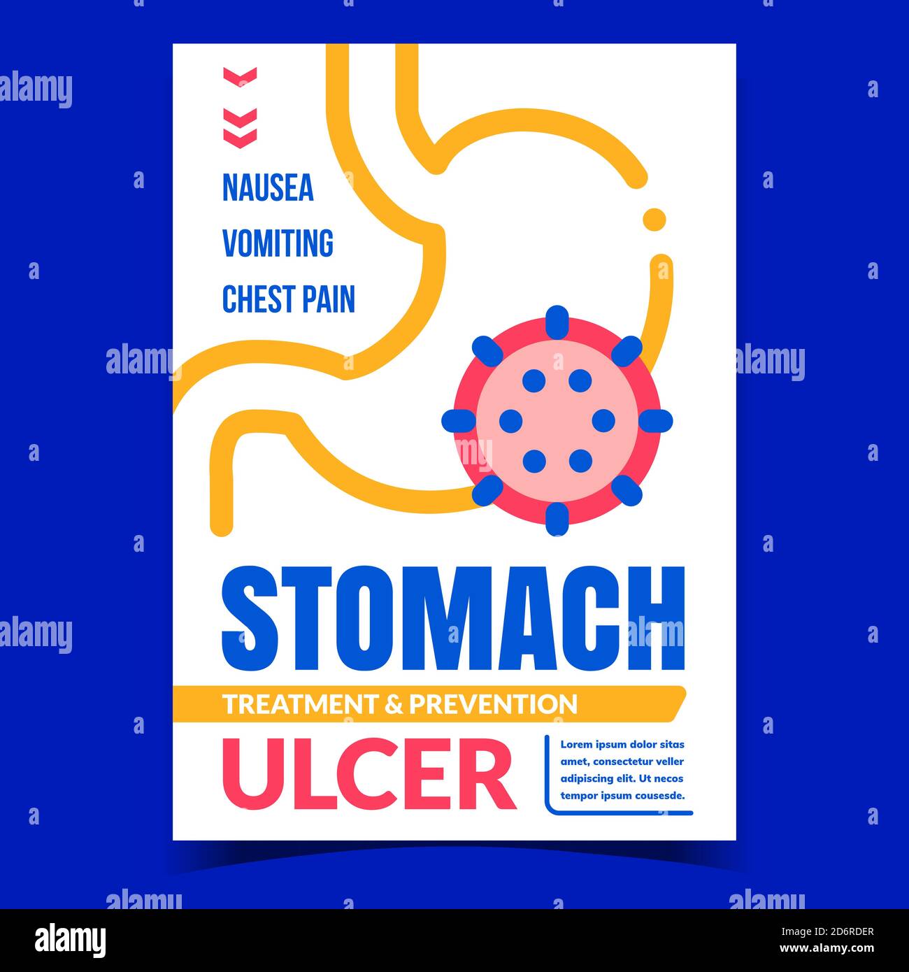 Stomach Ulcer Creative Promotional Poster Vector Stock Vector Image ...