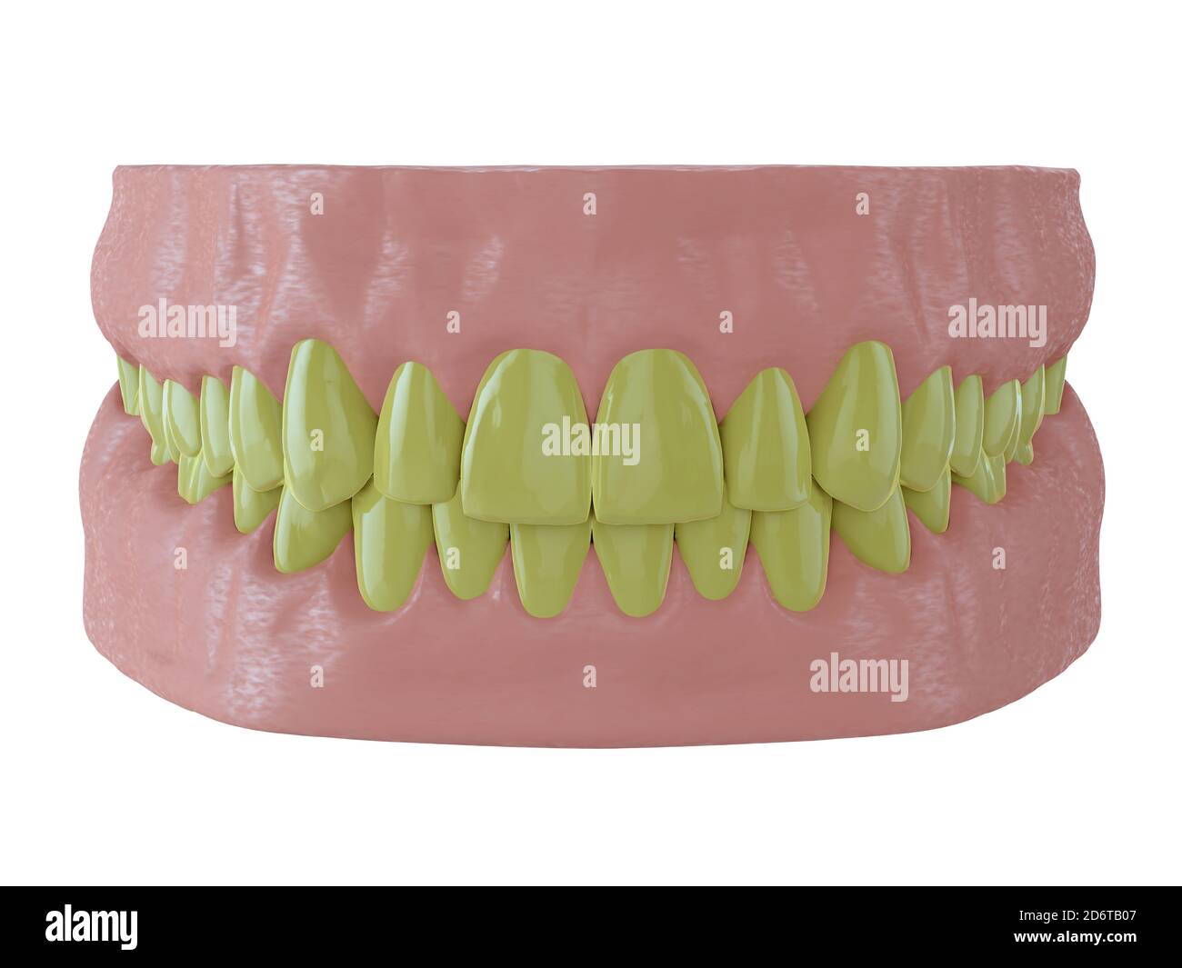 Yellow teeth white tooth hi-res stock photography and images - Alamy