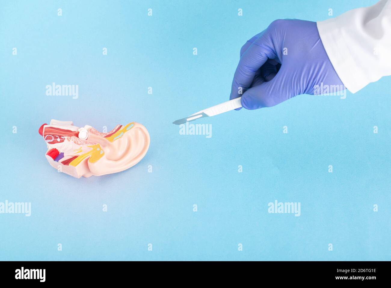 Parotid fistula resection hi-res stock photography and images - Alamy