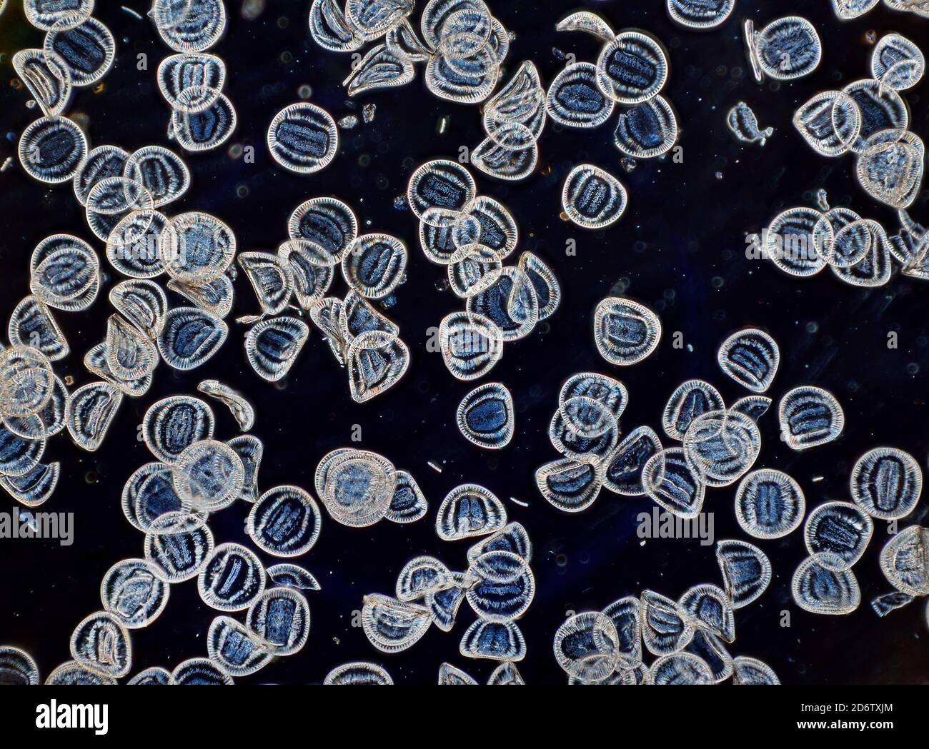 Diatoms, Campylodiscus clypeus Stock Photo - Alamy