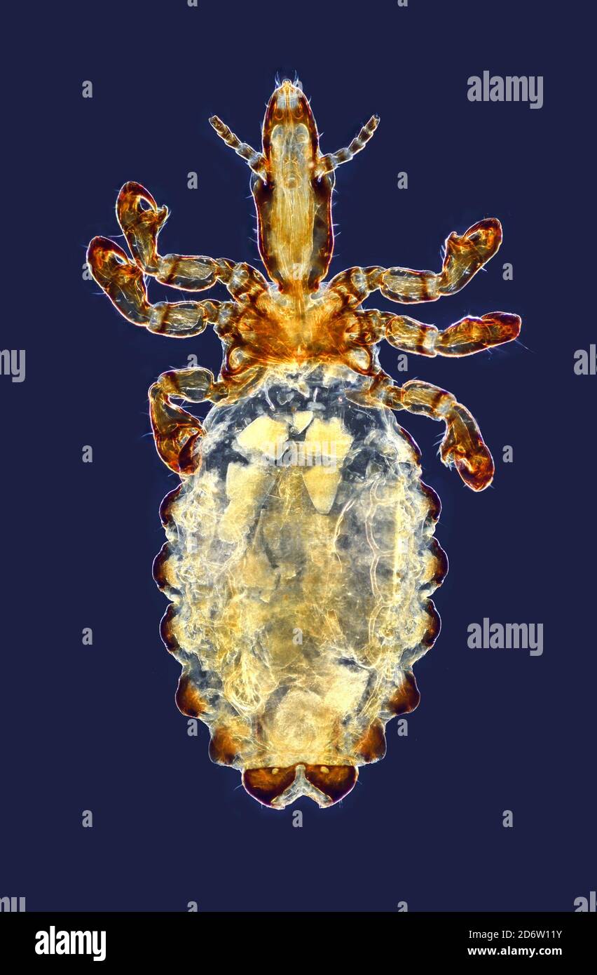 Pig louse hi-res stock photography and images - Alamy