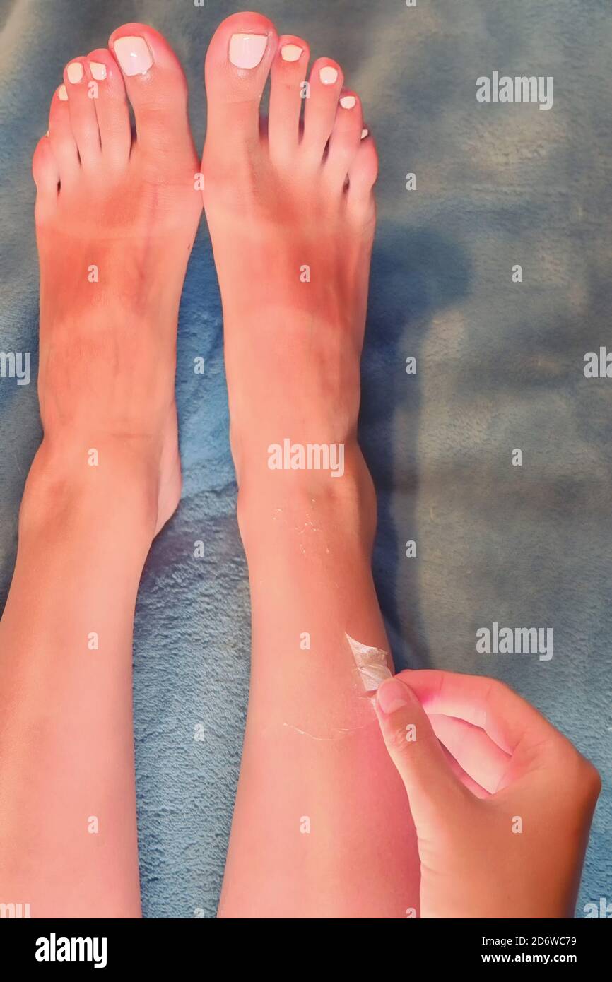 Leg peels hi-res stock photography and images - Alamy