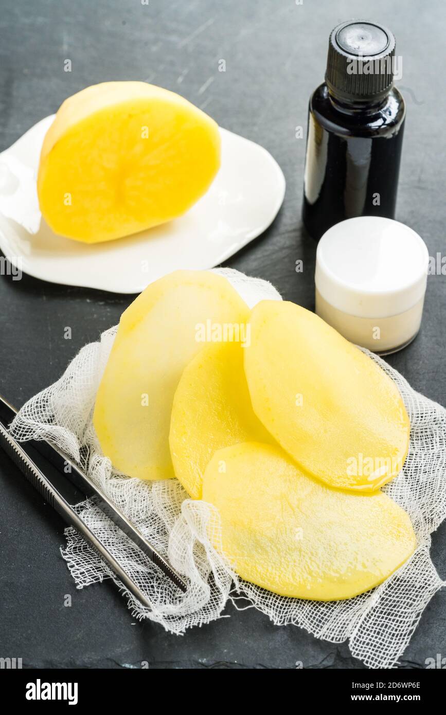 Use of potato to make beauty masks Stock Photo - Alamy