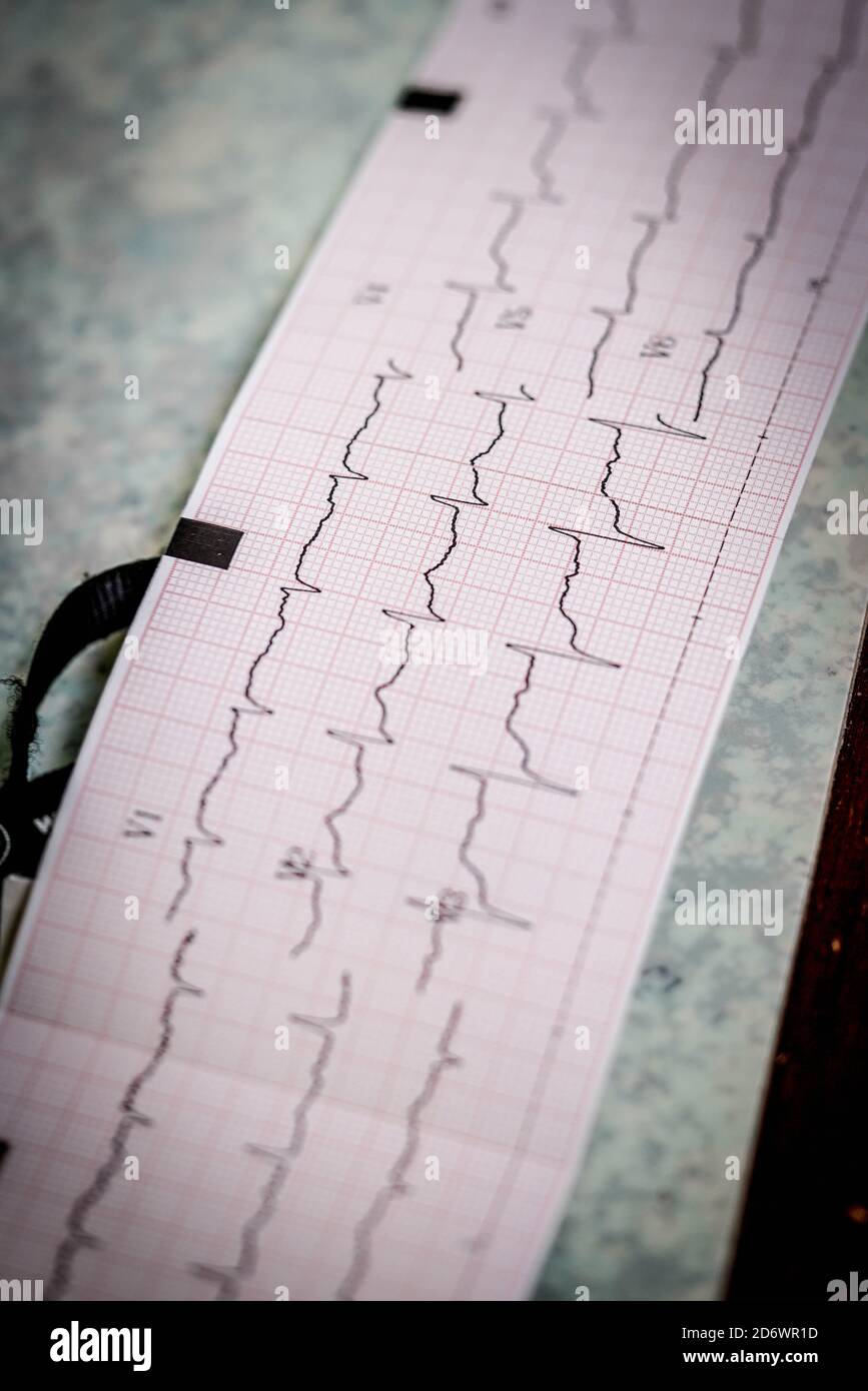 Ecg read out hi-res stock photography and images - Alamy