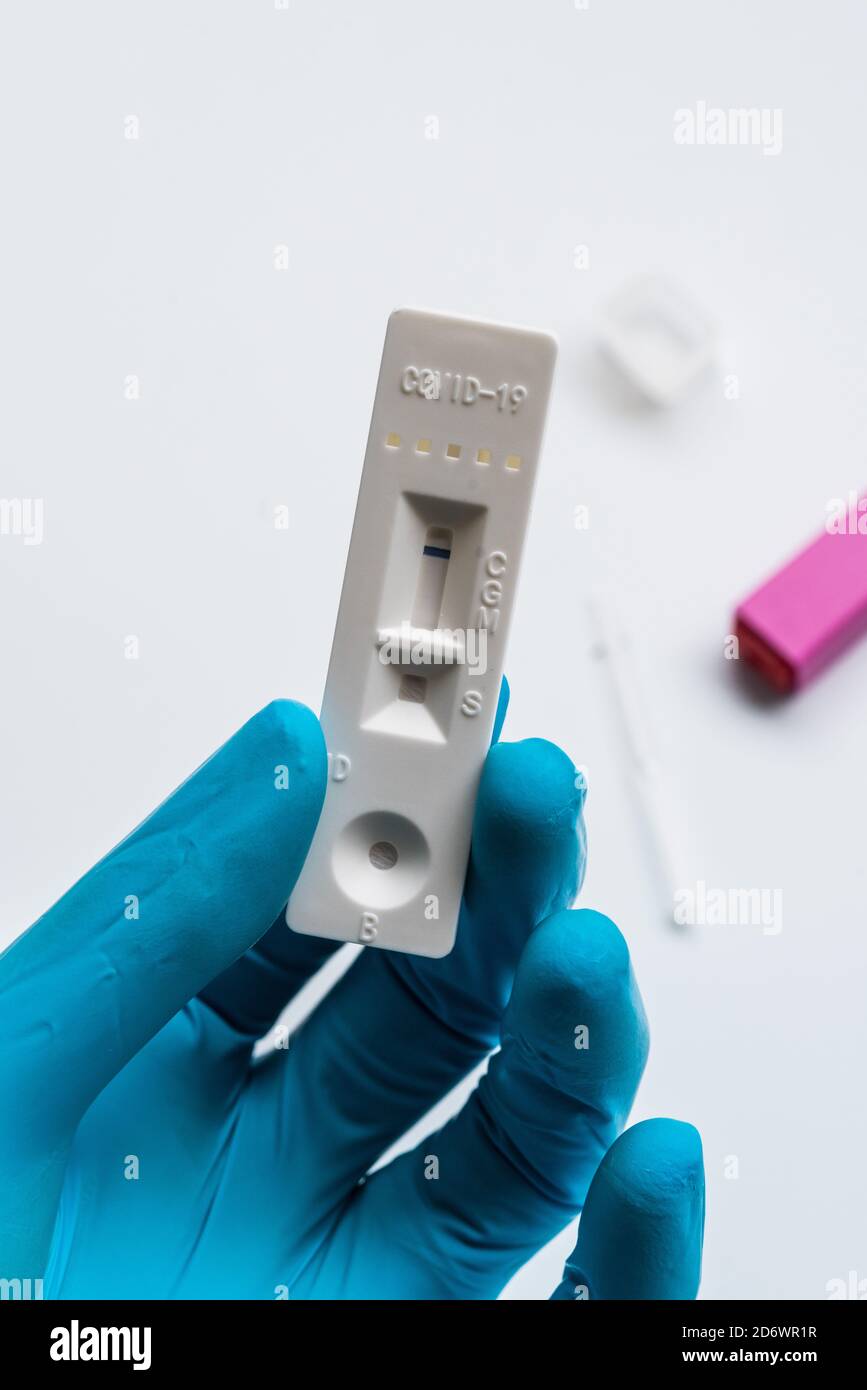 Serology test hi-res stock photography and images - Alamy