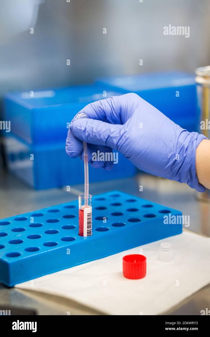 BIOFIRE ® FilmArray tests (Biomérieux laboratory) specifically ...