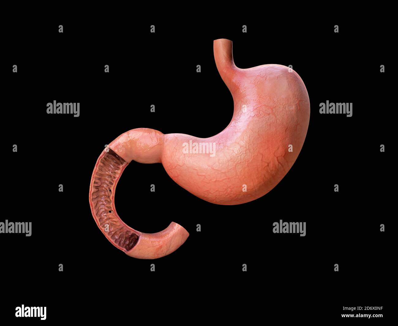 stomach, anatomy detail, illustration of a human stomach, rendering ...