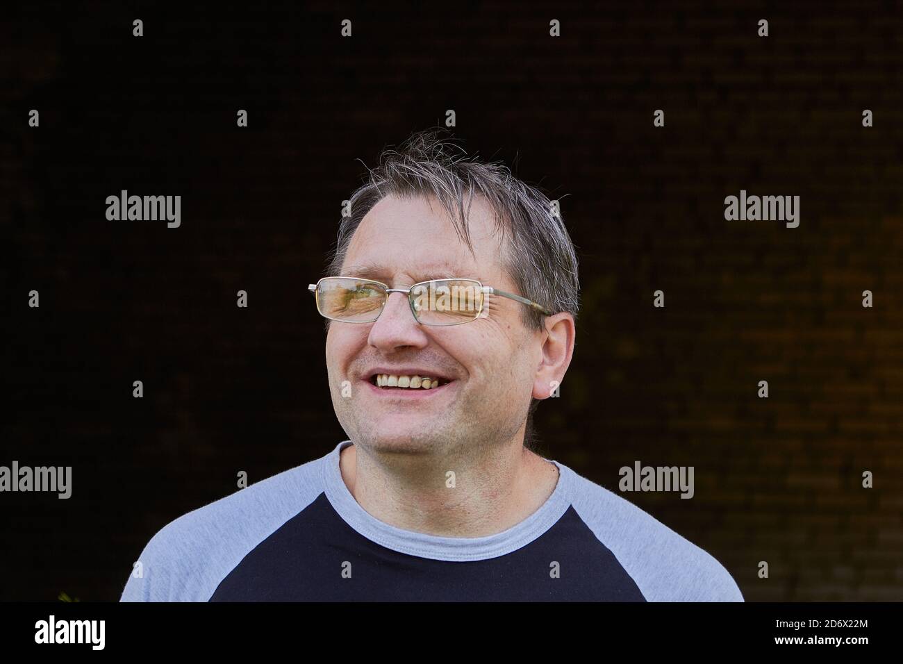 portrait of an adult male face, strabismus or exotropia Stock Photo - Alamy
