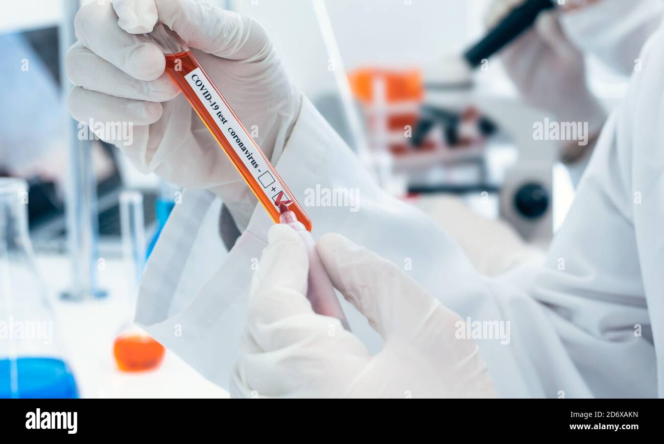 close up. lab technician making a mark on the tube with the test Stock ...