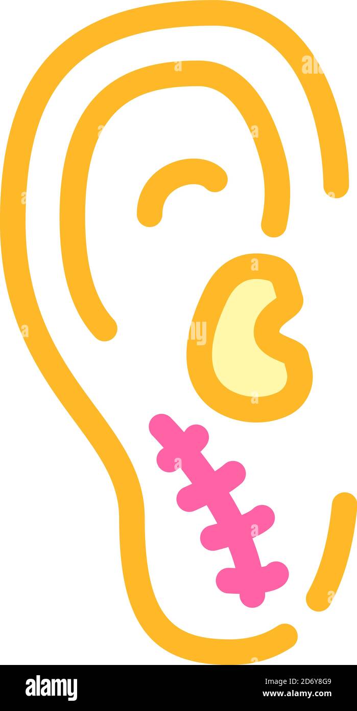 ear surgery color icon vector illustration sign Stock Vector Image ...