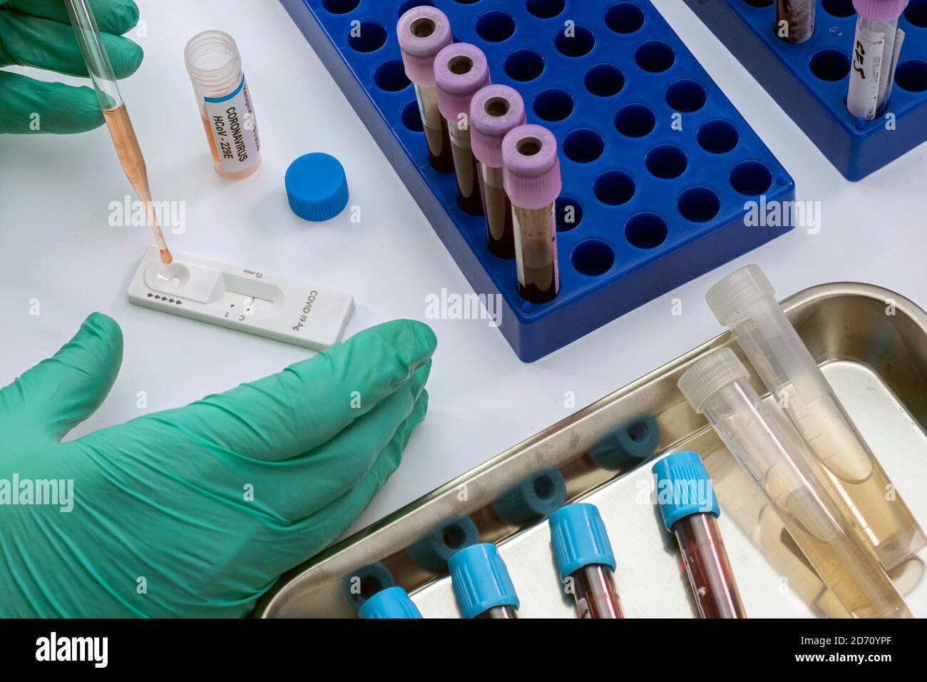 Positive pcr test hi-res stock photography and images - Alamy