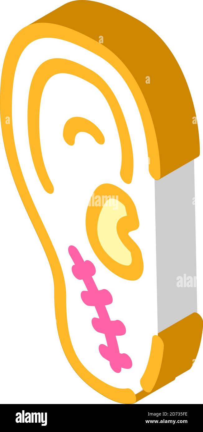 ear surgery isometric icon vector illustration sign Stock Vector Image ...