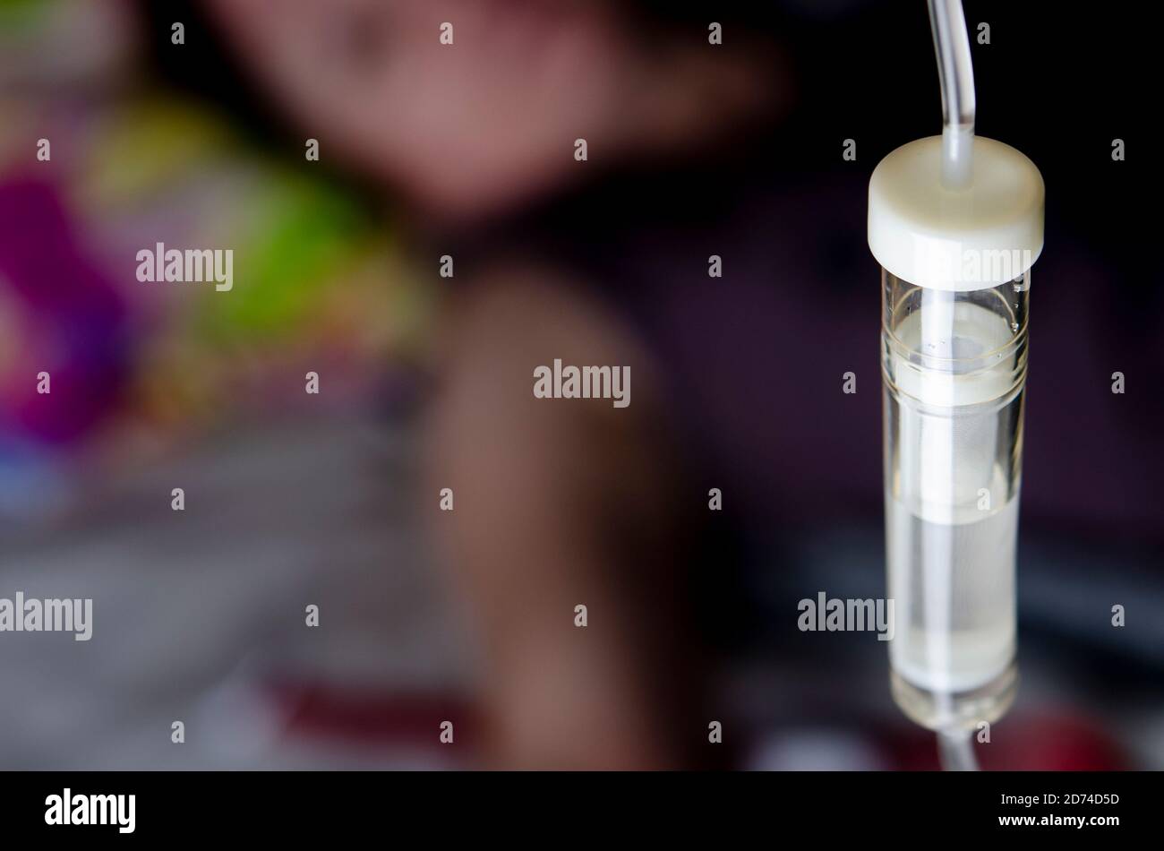 An infusion system filter for intravenous infusions Stock Photo - Alamy