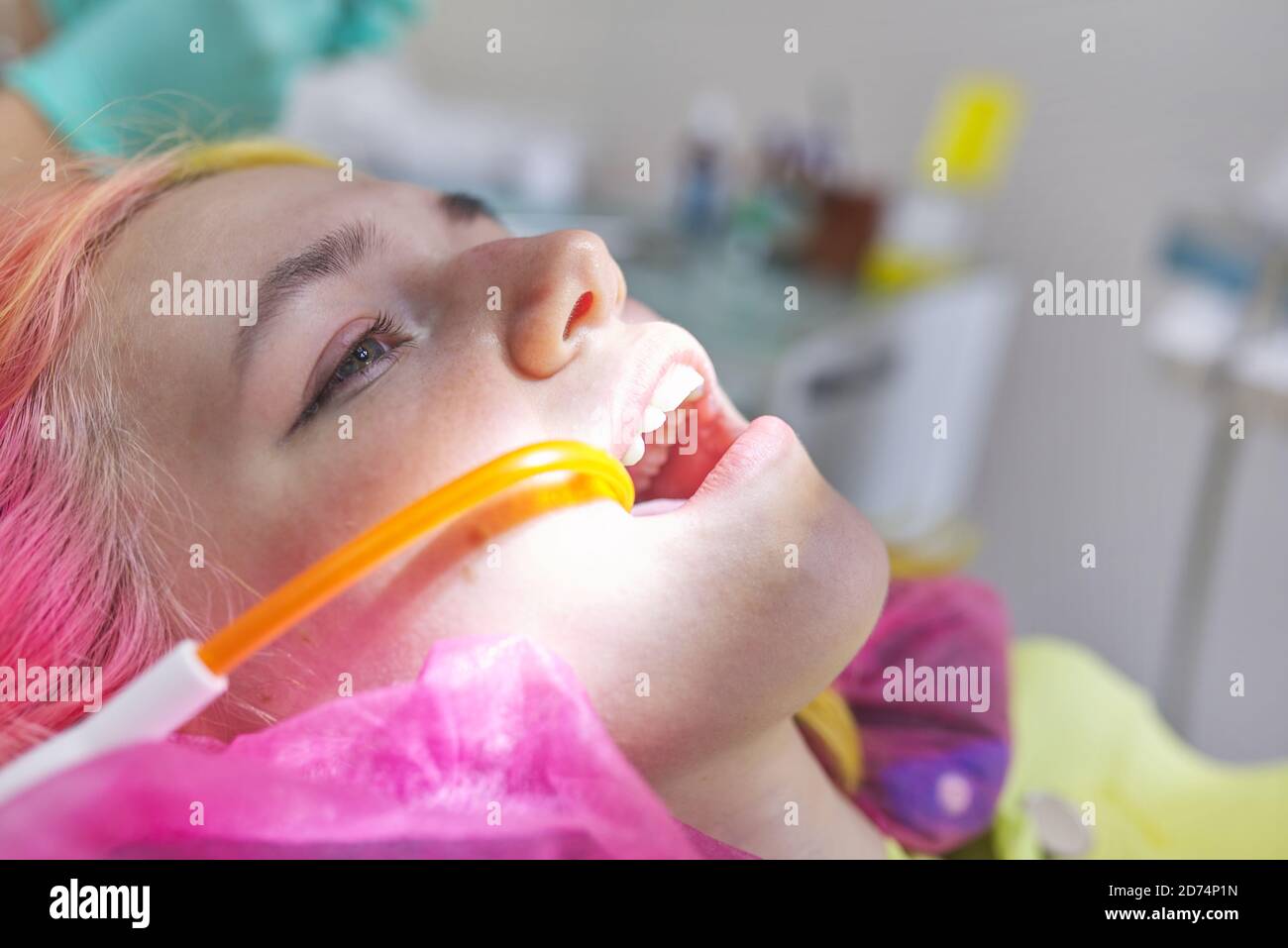 Patient's head with open mouth and saliva tube in mouth Stock Photo - Alamy