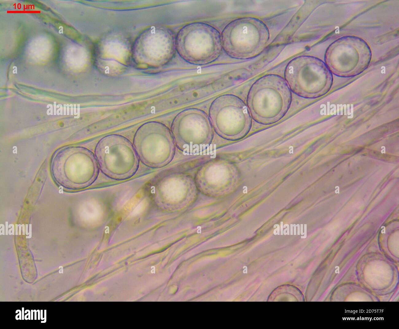 The Asci an Spores of Octospora affinis (mushroom) , stacked macro ...