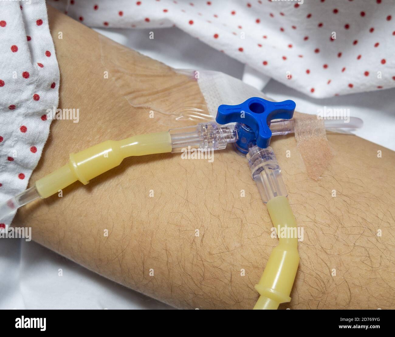Dialyzer hi-res stock photography and images - Alamy