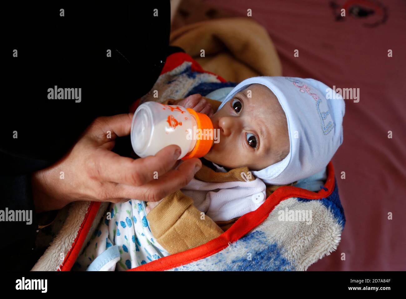 Acute food insecurity hi-res stock photography and images - Alamy