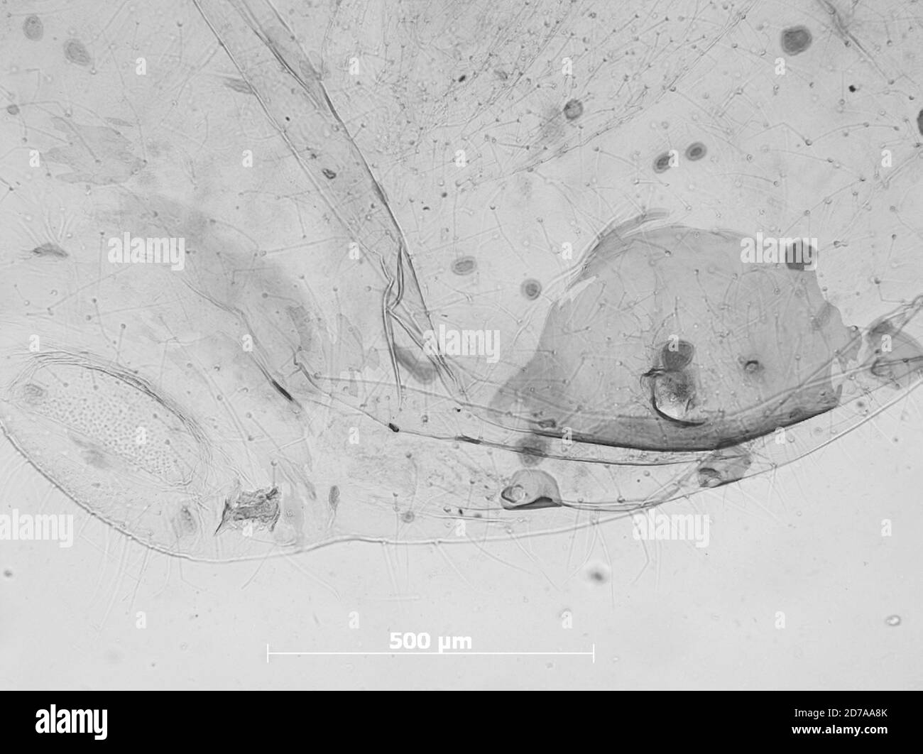 Boulder, Colorado, United States, Lachnus sibericae Gillette & Palmer ...