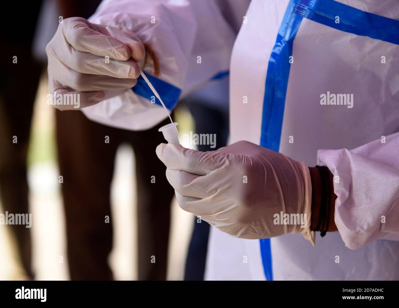 Collection of nasal swab samples hi-res stock photography and images ...