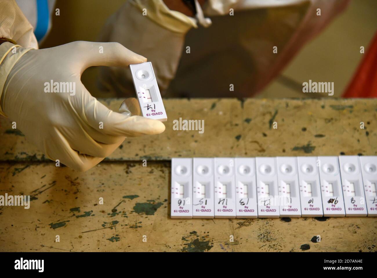 Rapid antigen test rat hi-res stock photography and images - Alamy