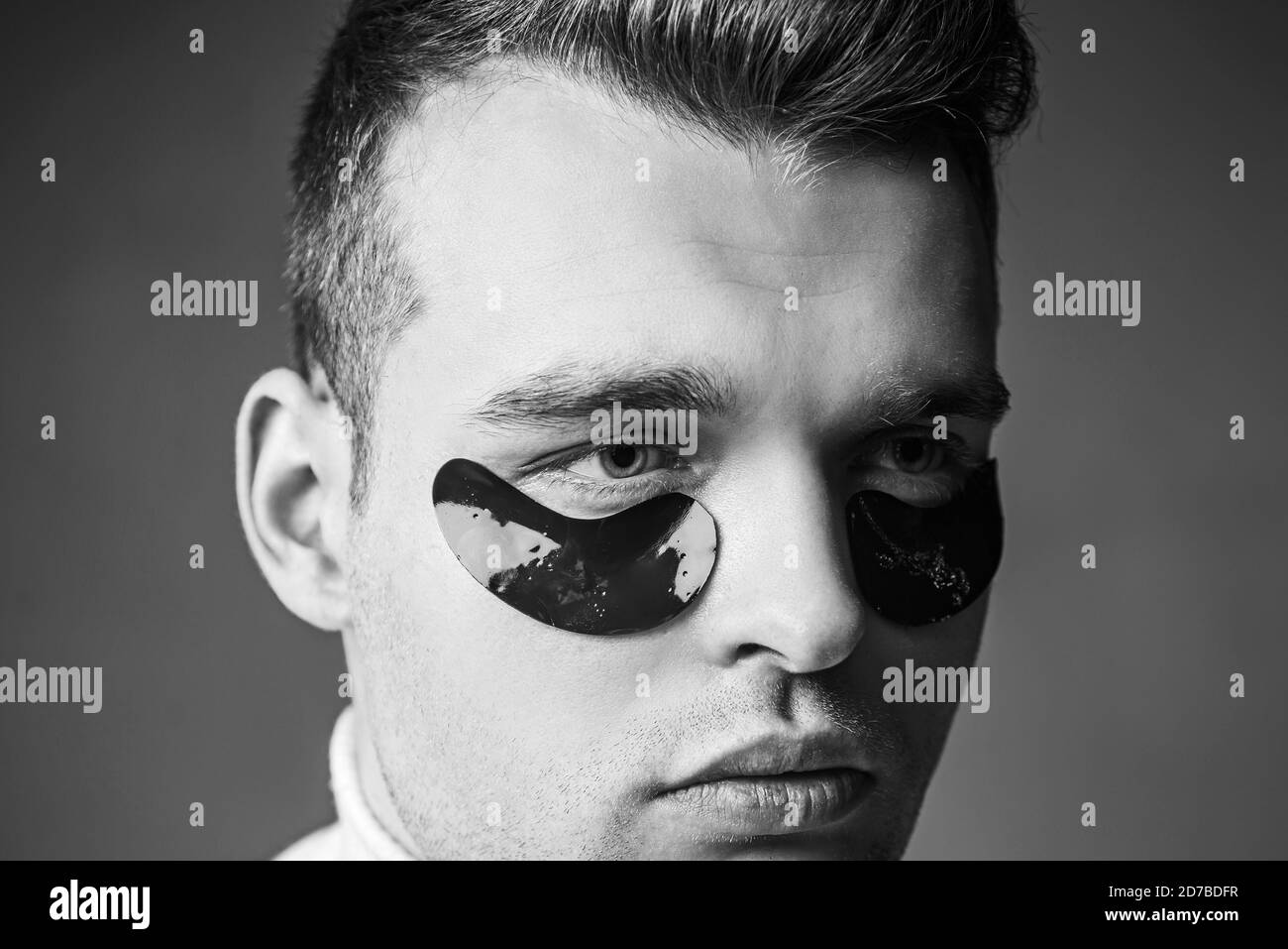 Inflammation or bag swelling under eye hi-res stock photography and ...