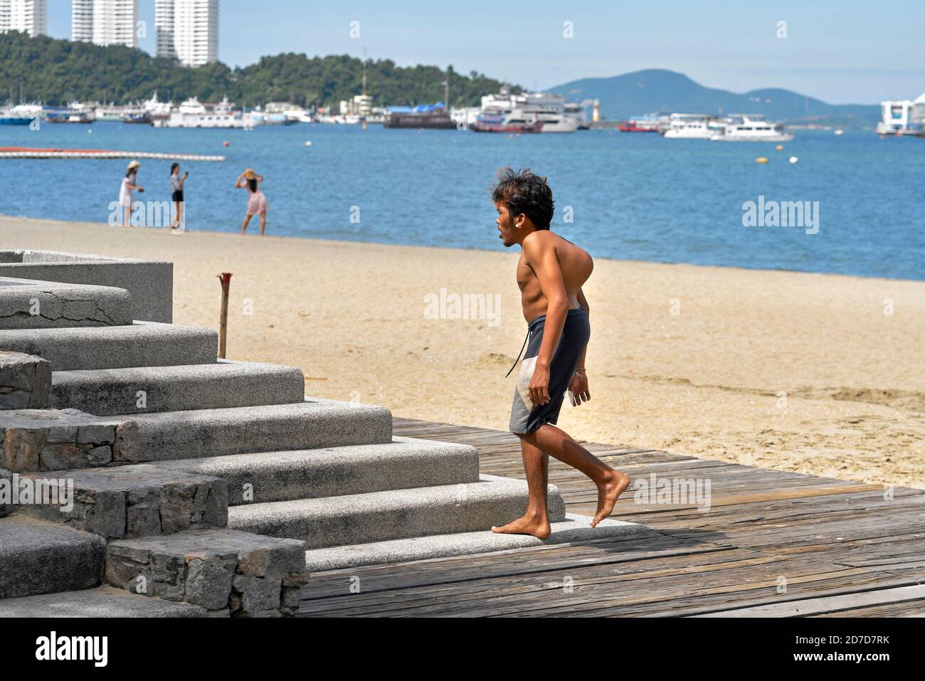 Spinal deformity possibly due to polio where the spine is hunched ...