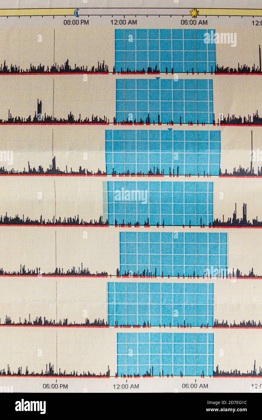 Seven day actigraph sleep assessment chart or graph report monitoring ...