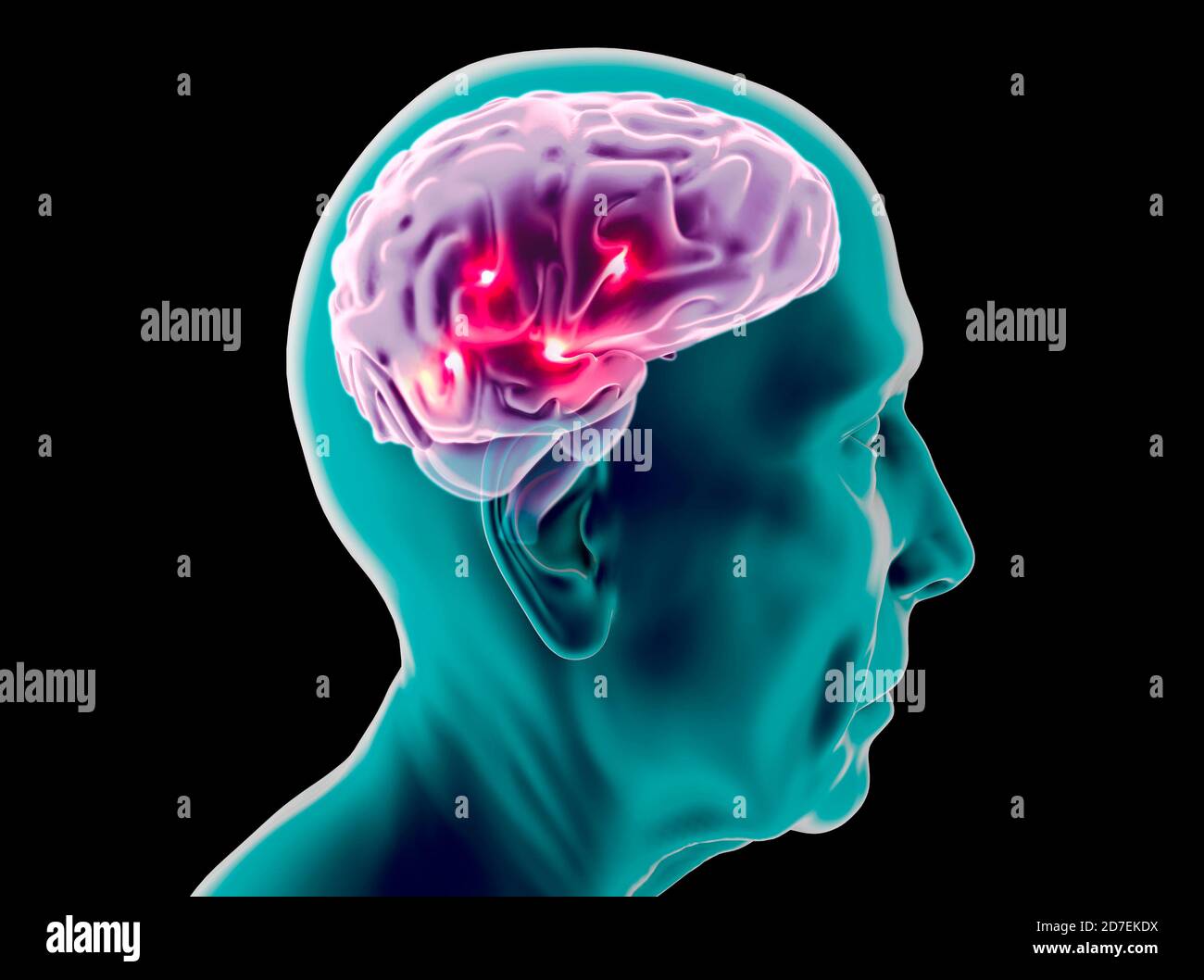 Lateral View Of The Brain Enchanted Learning Answers