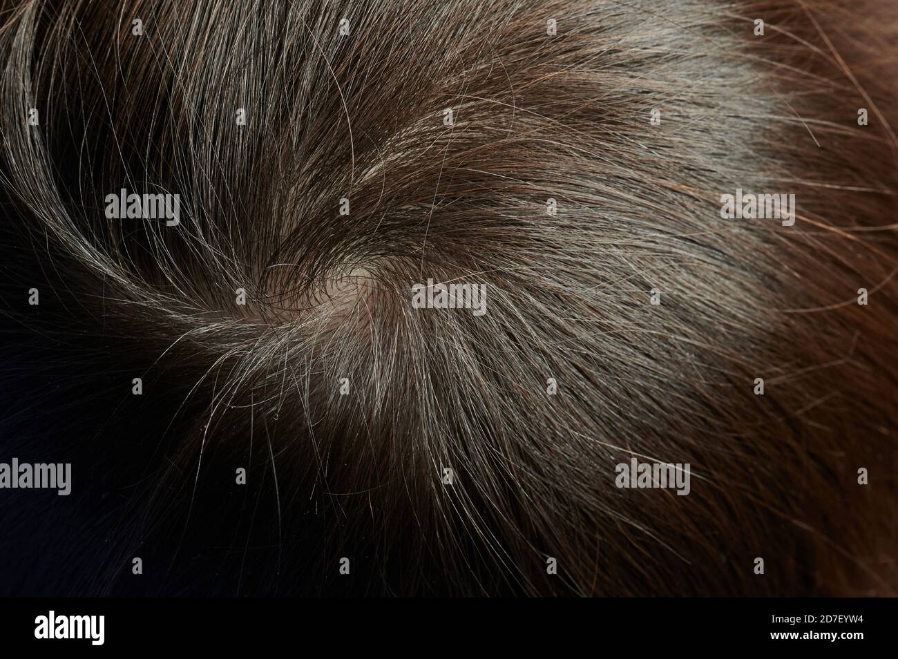 Occiput High Resolution Stock Photography and Images - Alamy