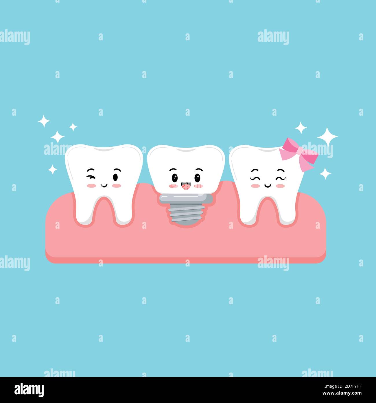 Cute healthy teeth root and dental implant in gum isolated on blue ...