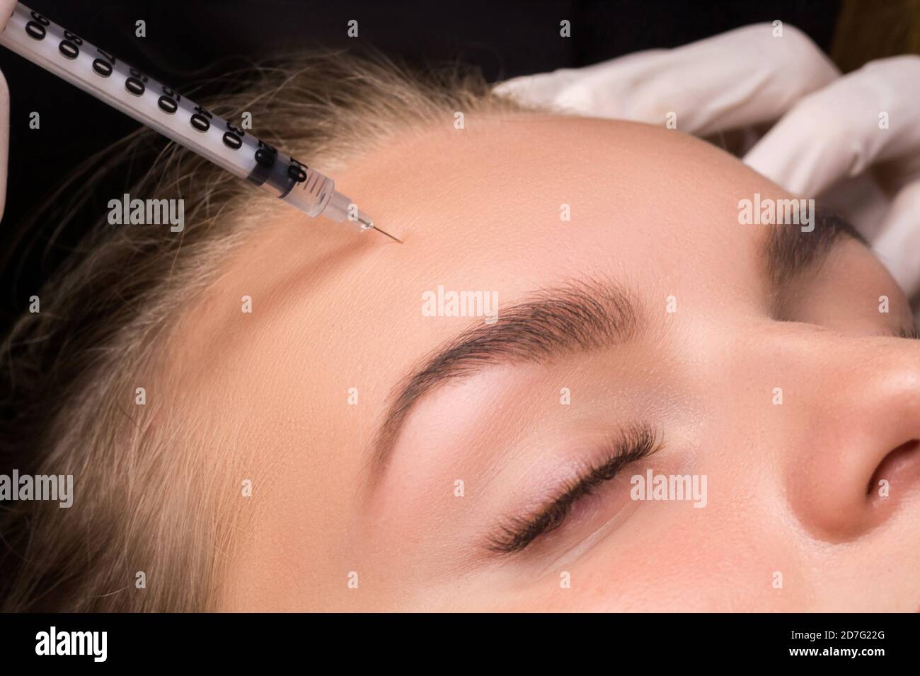 Woman inject face hi-res stock photography and images - Alamy