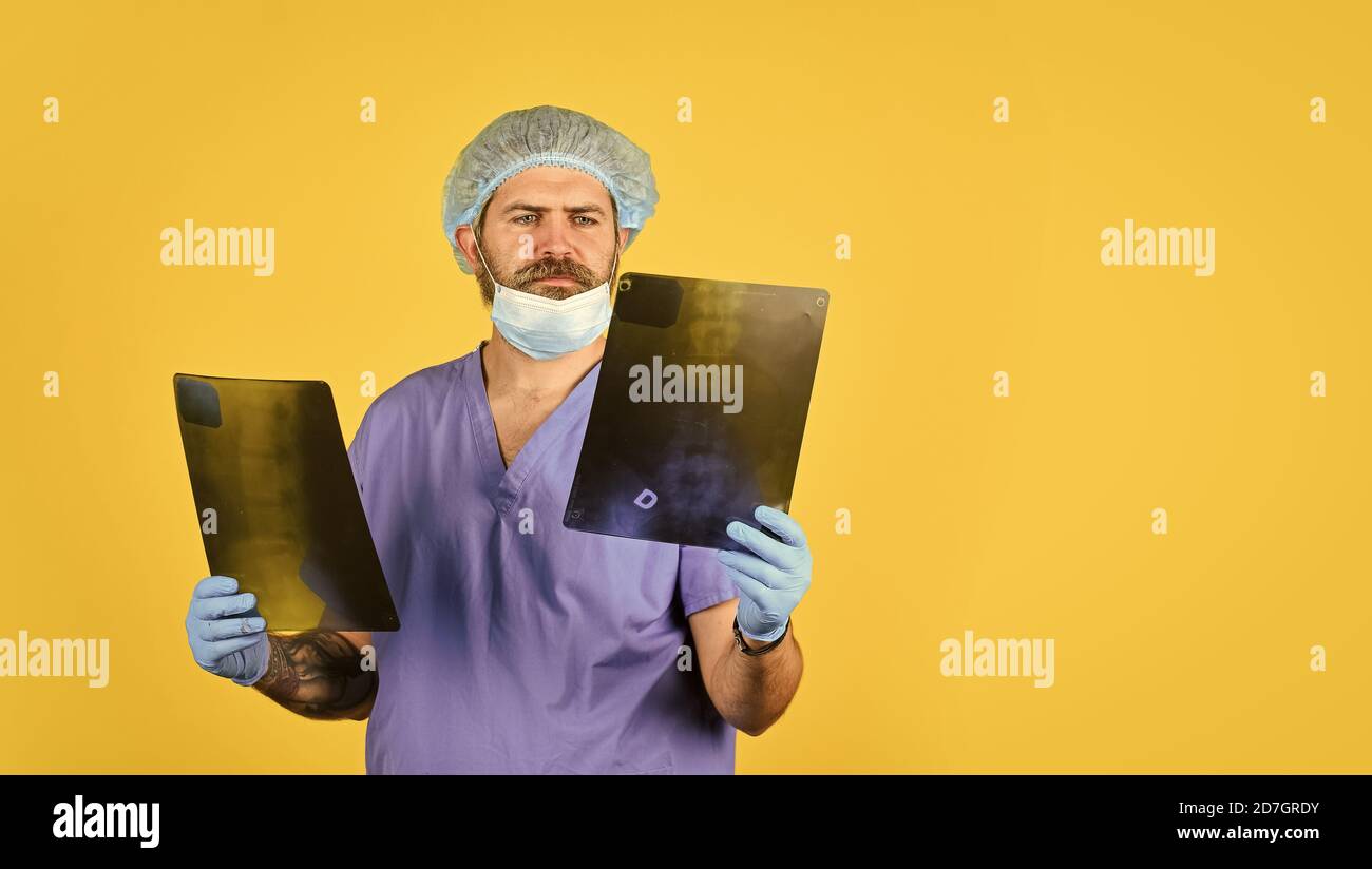 X-ray concept. X ray radiation. The doctor holds pictures of bones ...