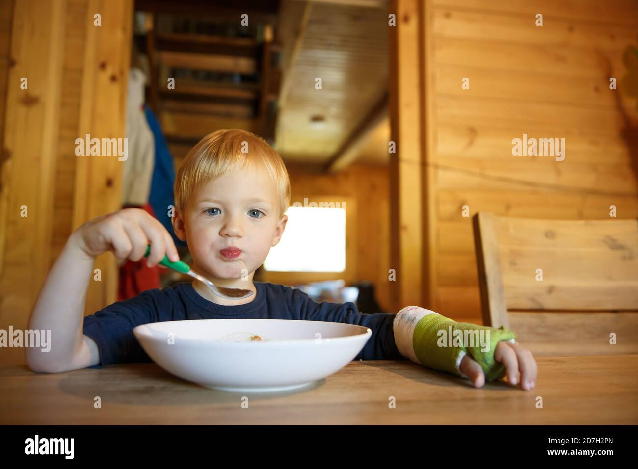 Little boy with a broken wrist eating at the table. Boy with a plaster ...