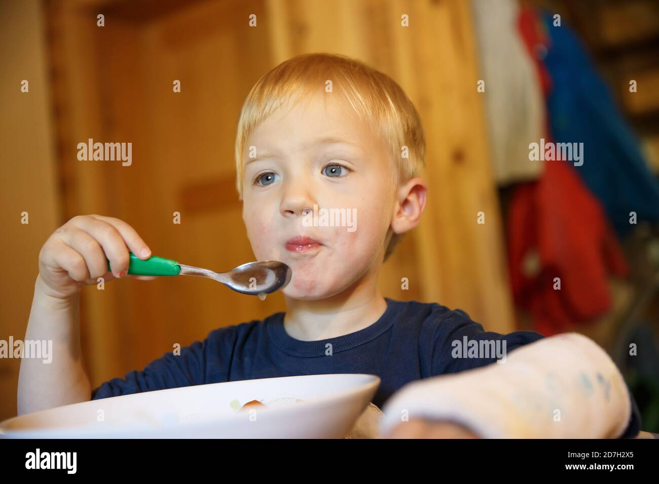 Little boy with a broken wrist eating at the table. Boy with a plaster ...